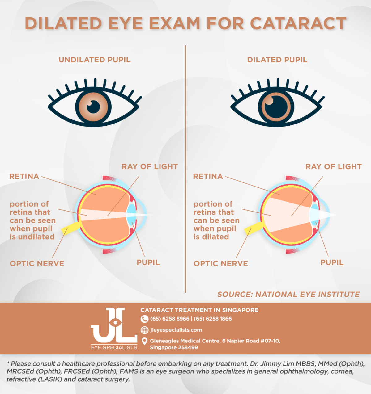 A Self-Assessment Guide for a Cataract Surgery Candidate
