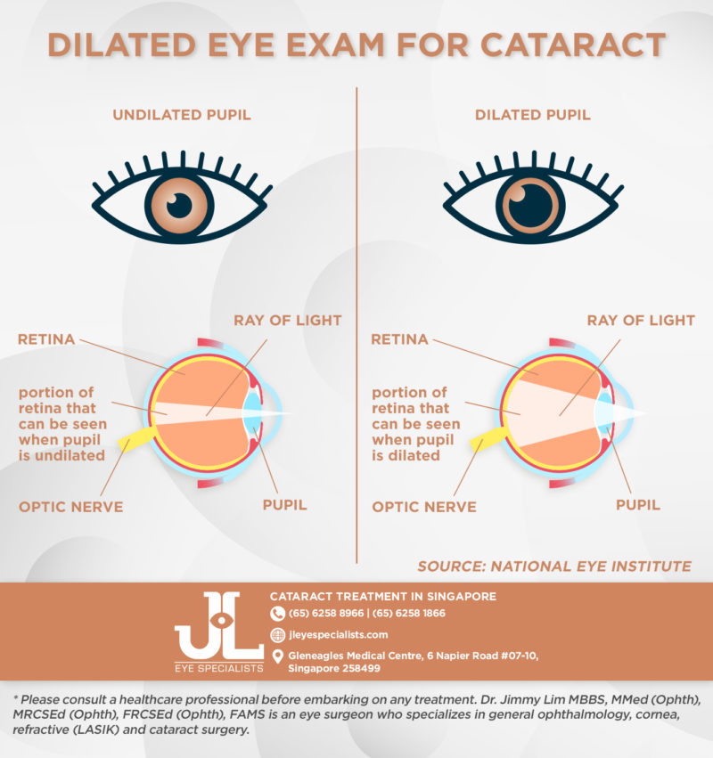 A Self-Assessment Guide for a Cataract Surgery Candidate